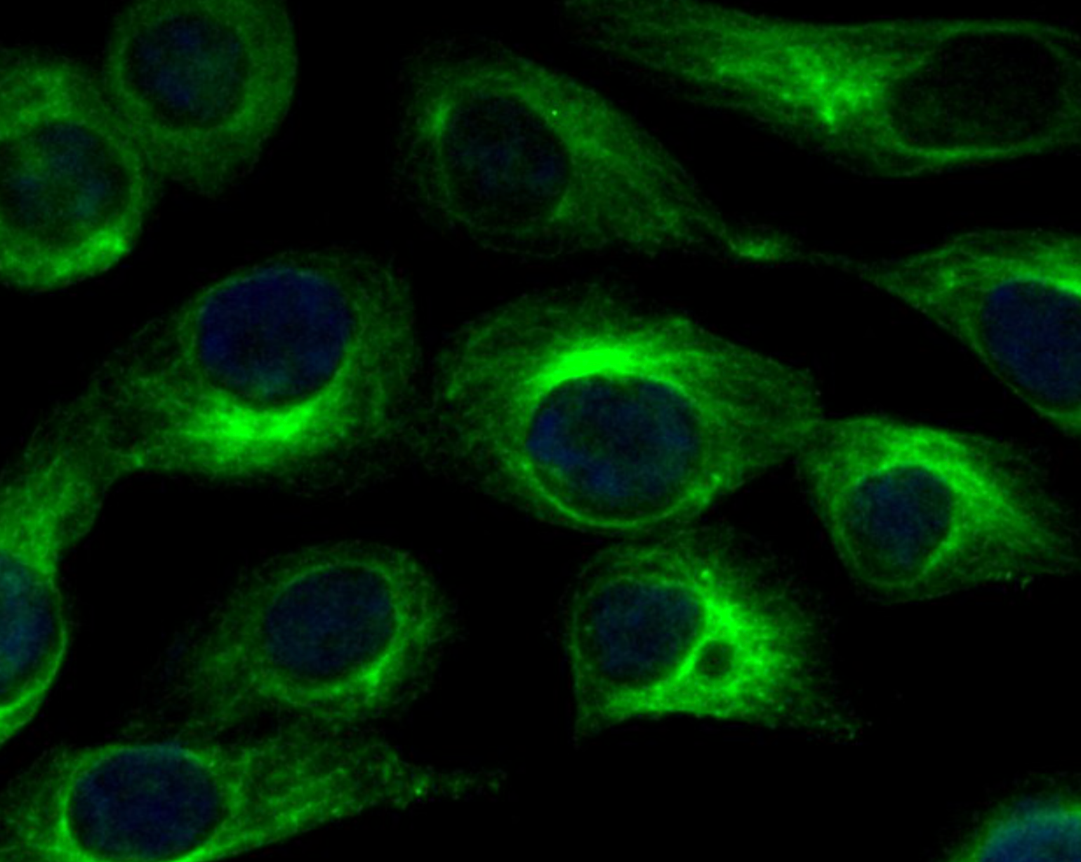 Rabbit Polyclonal Antibody Production | Rabbit Polyclonal Antibody ...